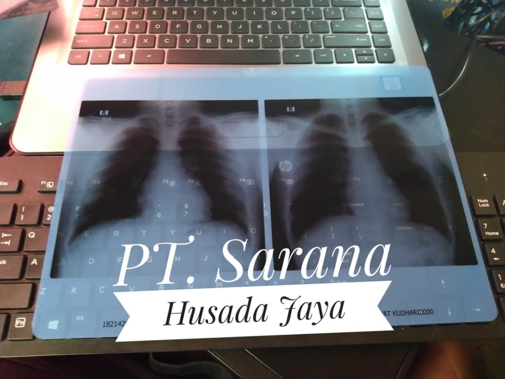 Sewa BUS RONTGEN , MCU X RAY On Site Seluruh Indonesia - ALAT X-RAY ...