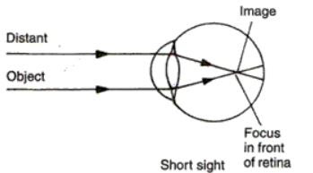 Frank Chapter 9 Nervous System ICSE Solutions Class 10 Biology