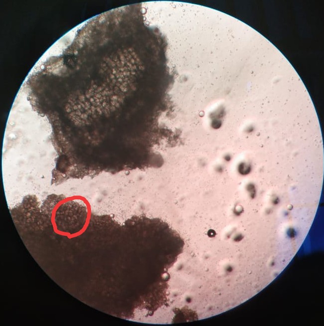 BENDA ERGASTIK ALEURON PADA TUMBUHAN