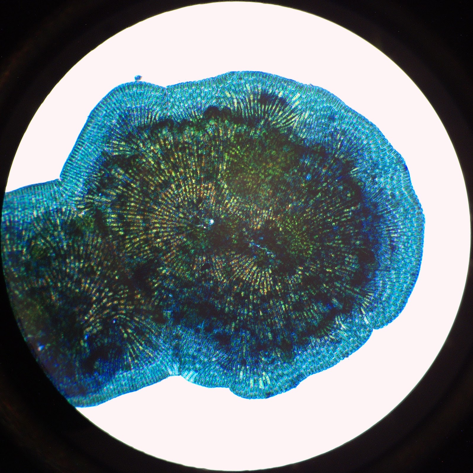 East Glamorgan Wildlife: A Micro Fungus.