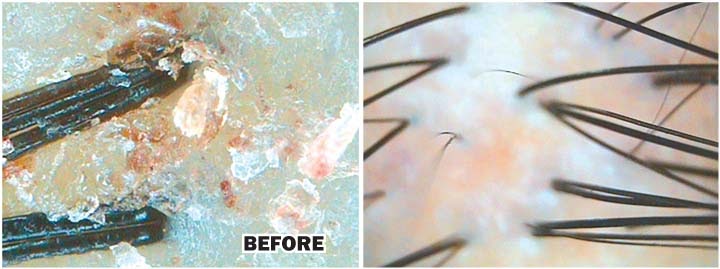 Scalp and Skin Blog: How To Reduce Sebum Production On the Scalp