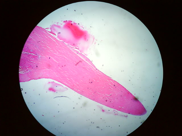 Ca - CaDo (Catatan Calon Dokter): Histologi Sistem Cardiovascular