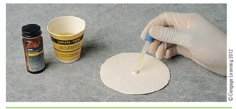 Uji Konfirmasi Pada Tes Urin