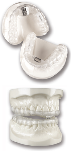 OrthoWorks: OrthoWorks Offers Sleep Apnea Treatment to San Francisco ...