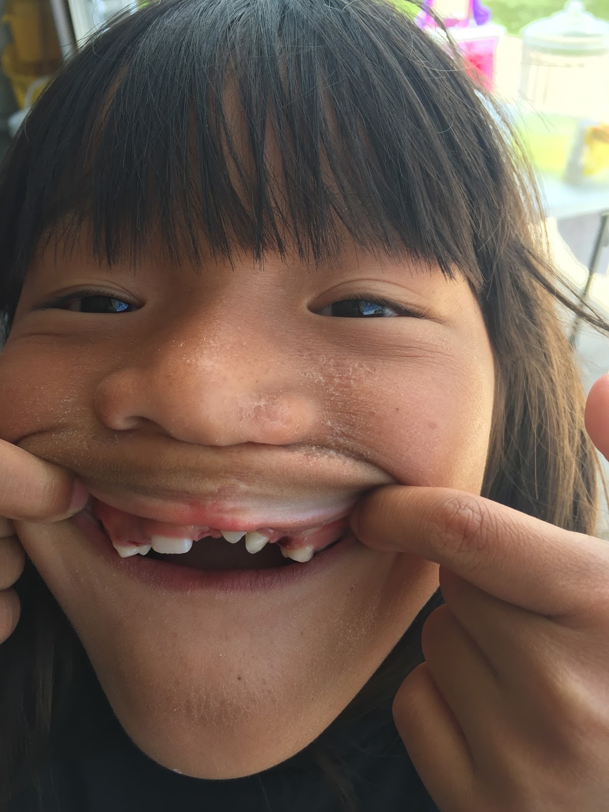 Houghtaling Girls: Ava's Wonky Tooth