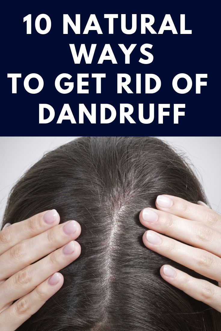 10 Best Home Remedies to Remove Dandruff! | healthy Round