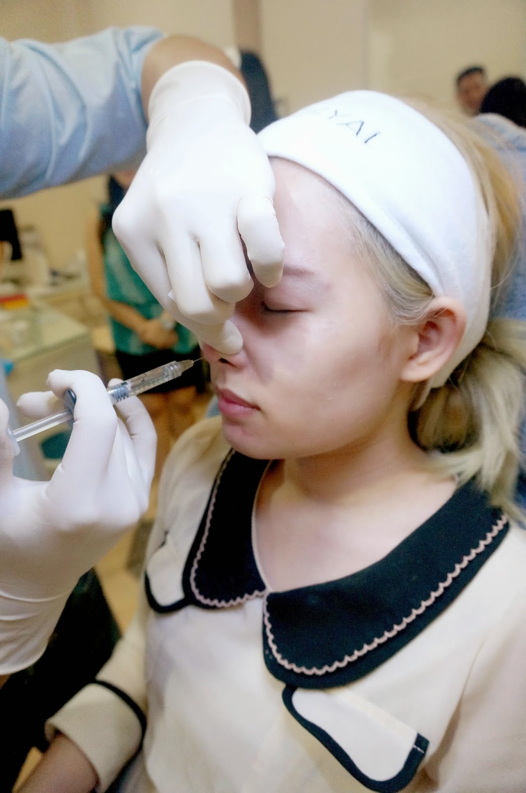 My Experience With Teosyal Ultra Deep and Teosyal Redensity II - Stella ...