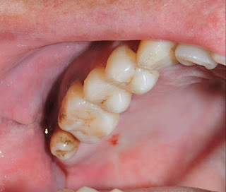 CLINICA DENTAL ASISTENCIAL: MICRODONCIA