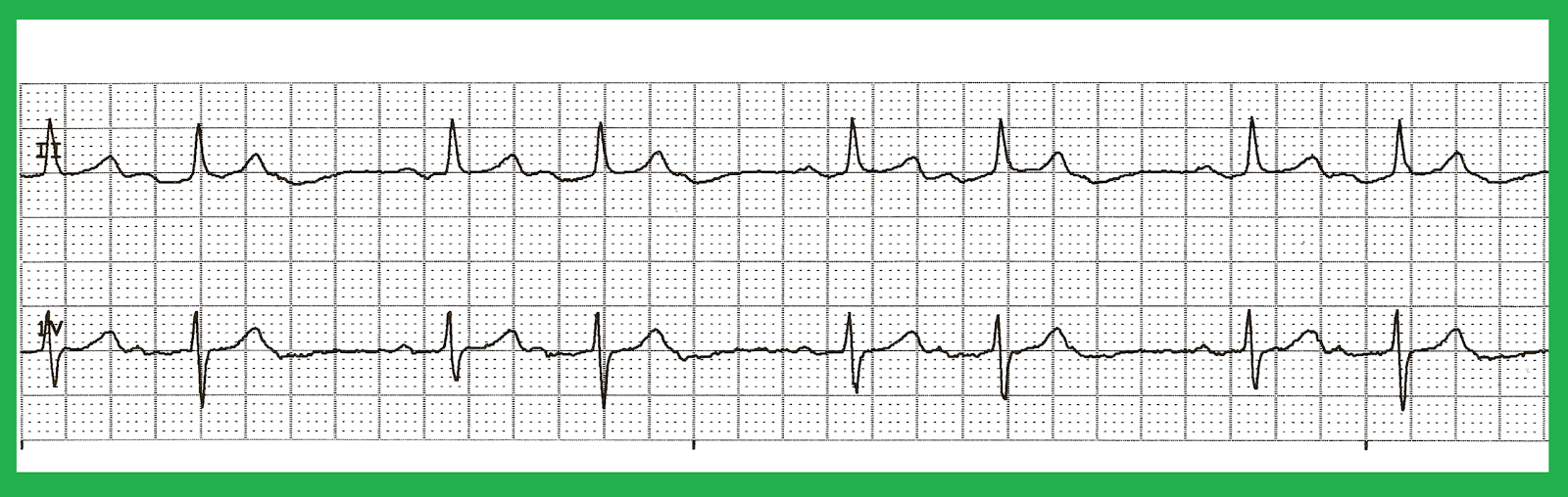 Practice Rhythm Strips 284