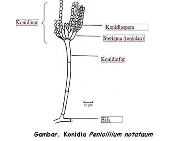 Klasifikasi Jamur( Zygomycota, Ascomycota, Basidiomycota, dan ...