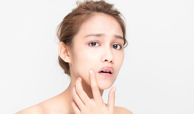 WHAT CAUSES WHITEHEADS AND HOW TO REMOVE THEM