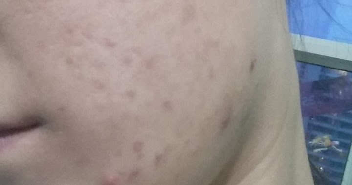 Makeup Artist's Choice Before/After Pics and Testimonials