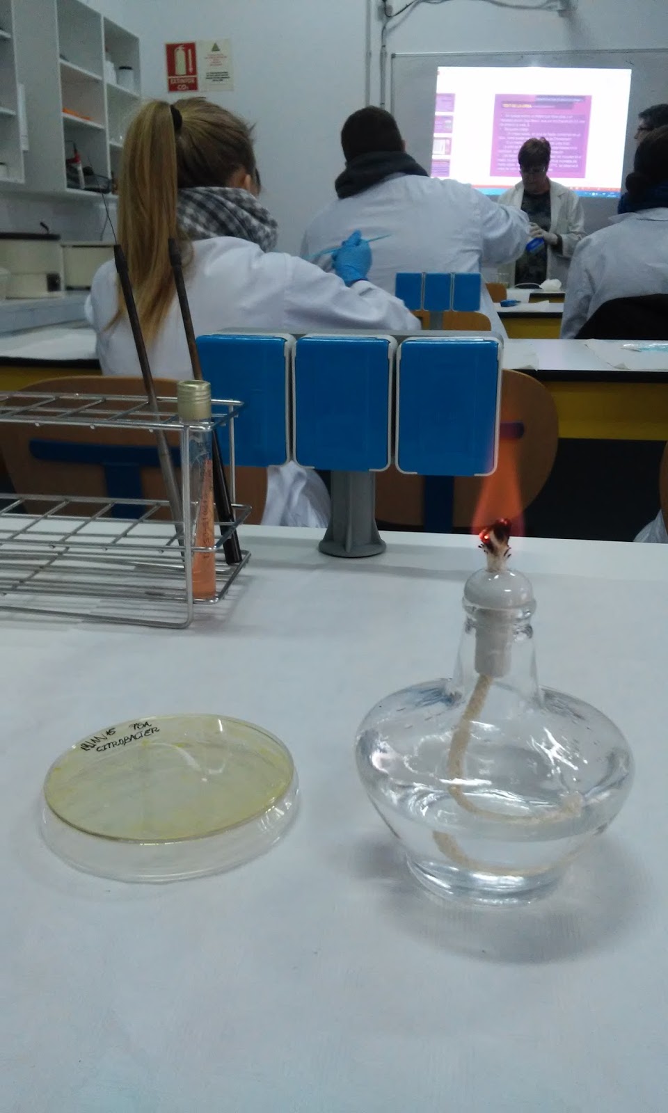 Microbiología: AGAR UREA