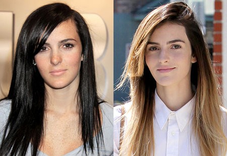 Ali Lohan Surgery