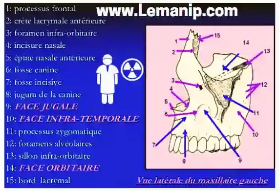 Radiographie Maxilaire (Machoire )