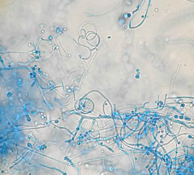 ATLAS MICOLOGIA: TRICHOPHYTON INTERDIGITALE