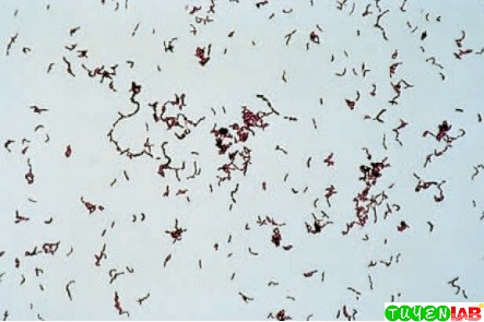 [Microbiology] Atlas of Anaerobes of Clinical Importance | Free Medical ...