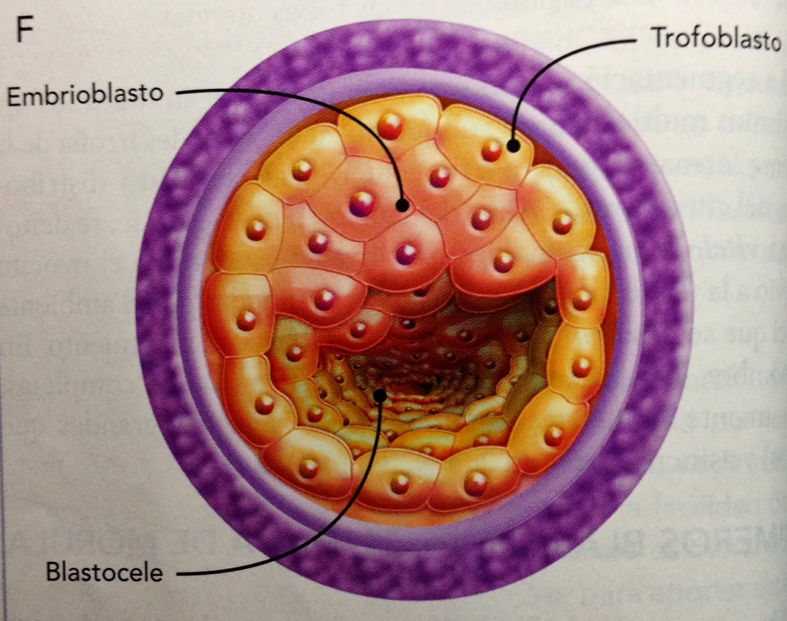 Trofoblasto De Inserção Difusa - BRAINCP
