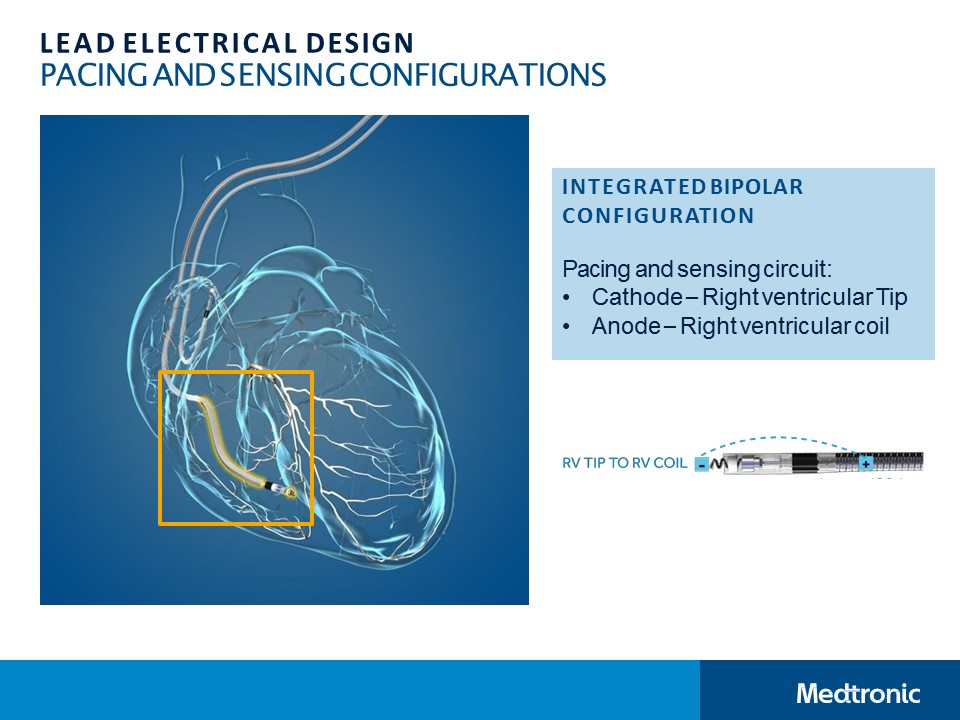 CVT Mohd Farid: Concept Of ICD Technology-Sensing & Detection-Medtronic ...