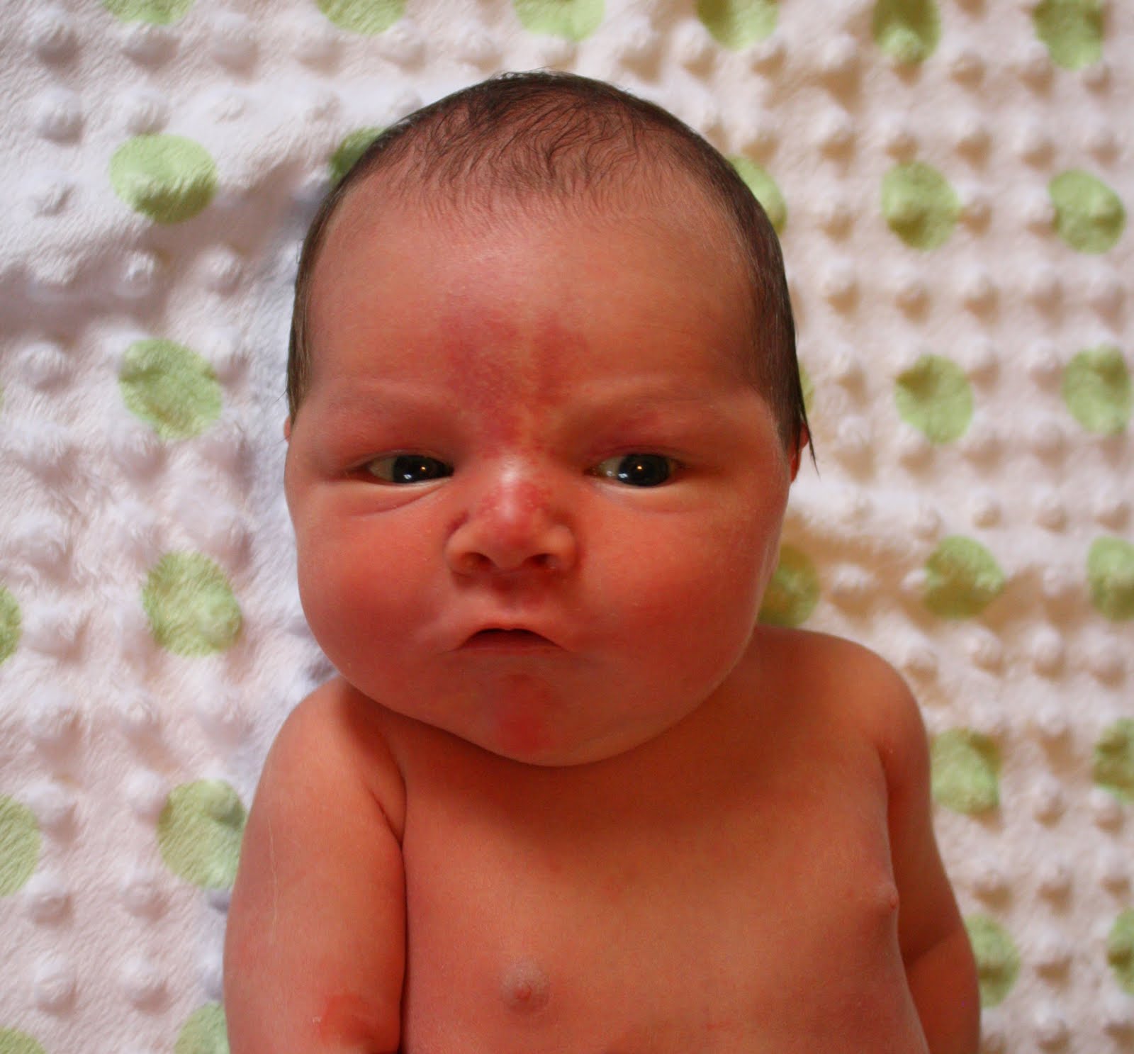 Martin Family Moments: The Fading Birthmark