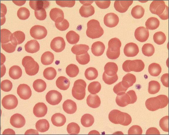 silviaquerida: Tentang TROMBOSIT