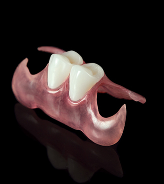 Prótese Parcial Flexível - Descubra TUDO Sobre Este Tratamento: O Que é ...