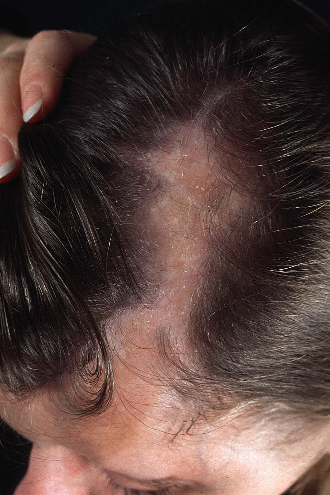 Fases del pelo