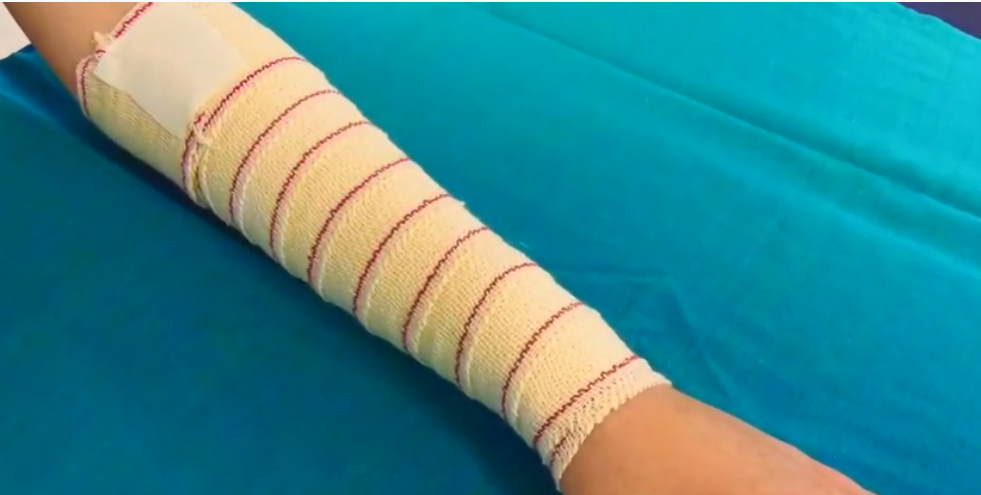 LAVADO DE MANOS: PRACTICAS DE VENDAJES