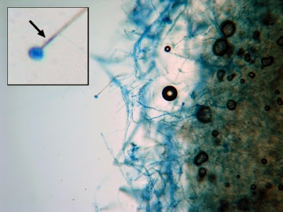 Fun With Microbiology (What's Buggin' You?): Apophysomyces elegans ...
