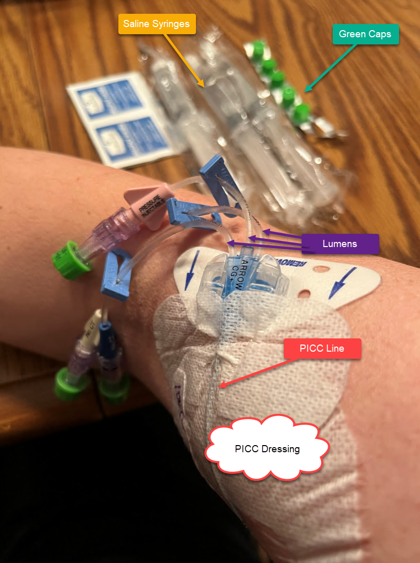 My Battle with Myxoid Liposarcoma