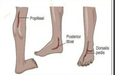 PULSE - HOW TO MEASUREMENT