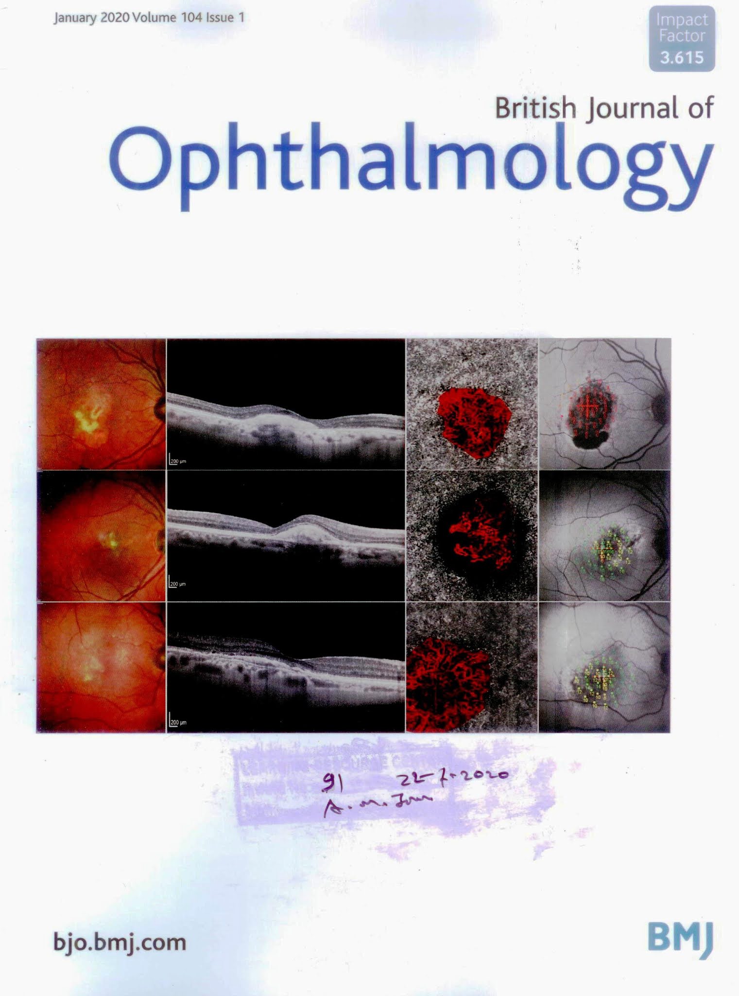 British Journal of Ophthalmology V 104 I 01 - LRC