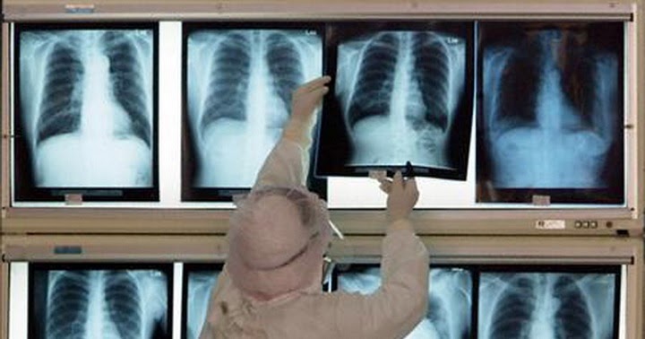 Bagaimana Sinar-X Ditemukan? | Belajar Sampai Mati