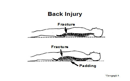 Care Hub: How to Treat Broken Bones - First Aid Training