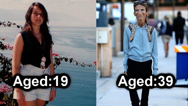 Manusia Terkurus Di Dunia