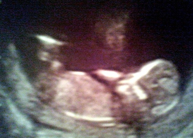 Life Spot: Ultrasound shows angel watching unborn baby!