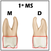 Anatomia do Primeiro Molar Superior - Resumo de Anatomia Dental