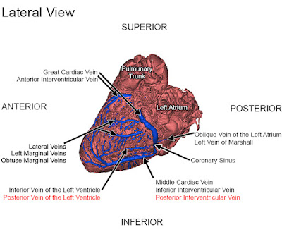 CVT Mohd Farid: Vein Of Marshall And Its Clinical Significant