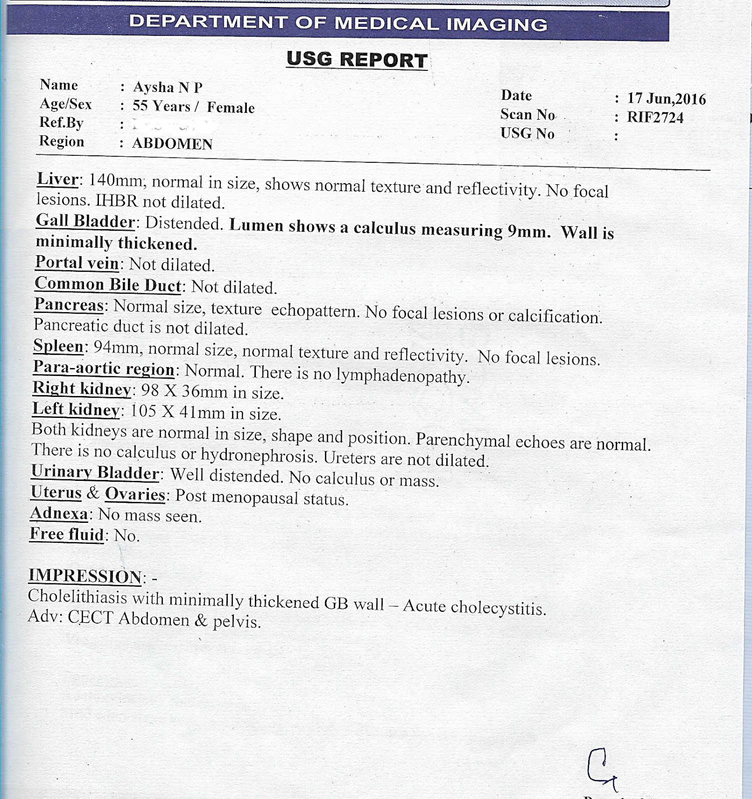 Dr.Akbar homeopathy: GALL BLADDER CALCULUS