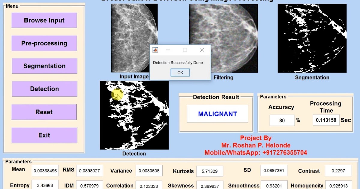Matlab Code For Breast Cancer Detection Using Image Processing