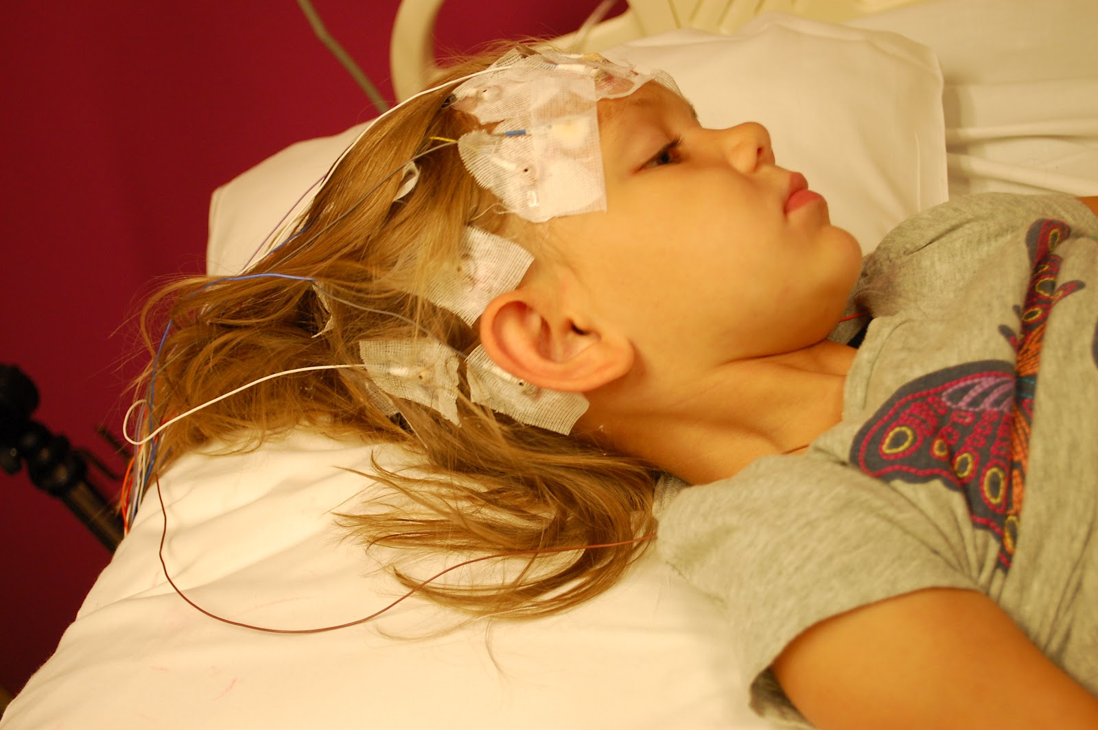 Miniature Stump: EEG 08/02/12