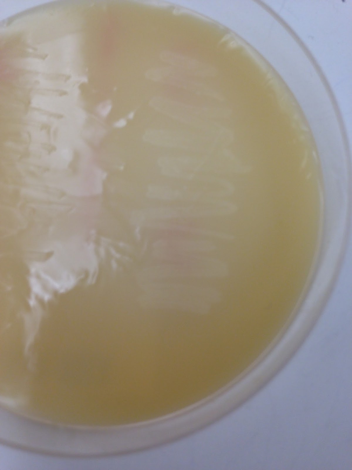 Microbiology Mania: Lipid, Casein, and Starch Tests {Lab 7 - May 20, 2015}