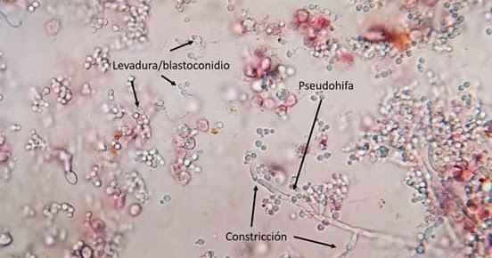 Ciencias de la Salud: Candida: levaduras, pseudohifas e hifas y su ...