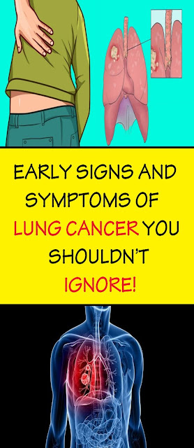 Early Warning Symptoms Of Lung Cancer You Shouldnt Ignore Healthcare Global