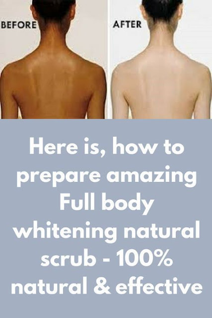 Full Body Whitening At Home With This Natural Bleach - Healthy Zone