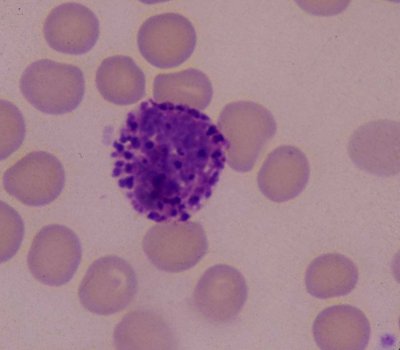 Células sanguíneas : Elementos formes de la sangre