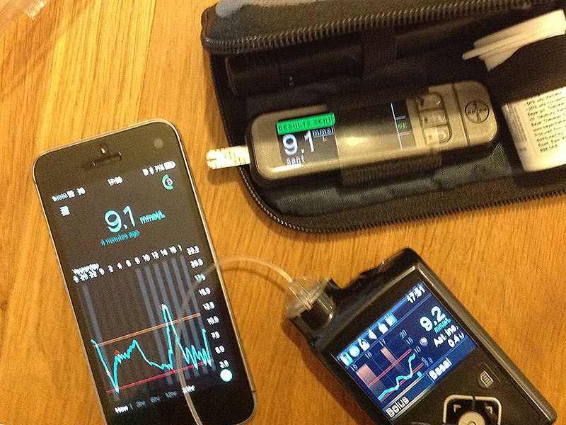 Every day ups and downs, a diabetes blog: Medtronic Guardian Connect ...