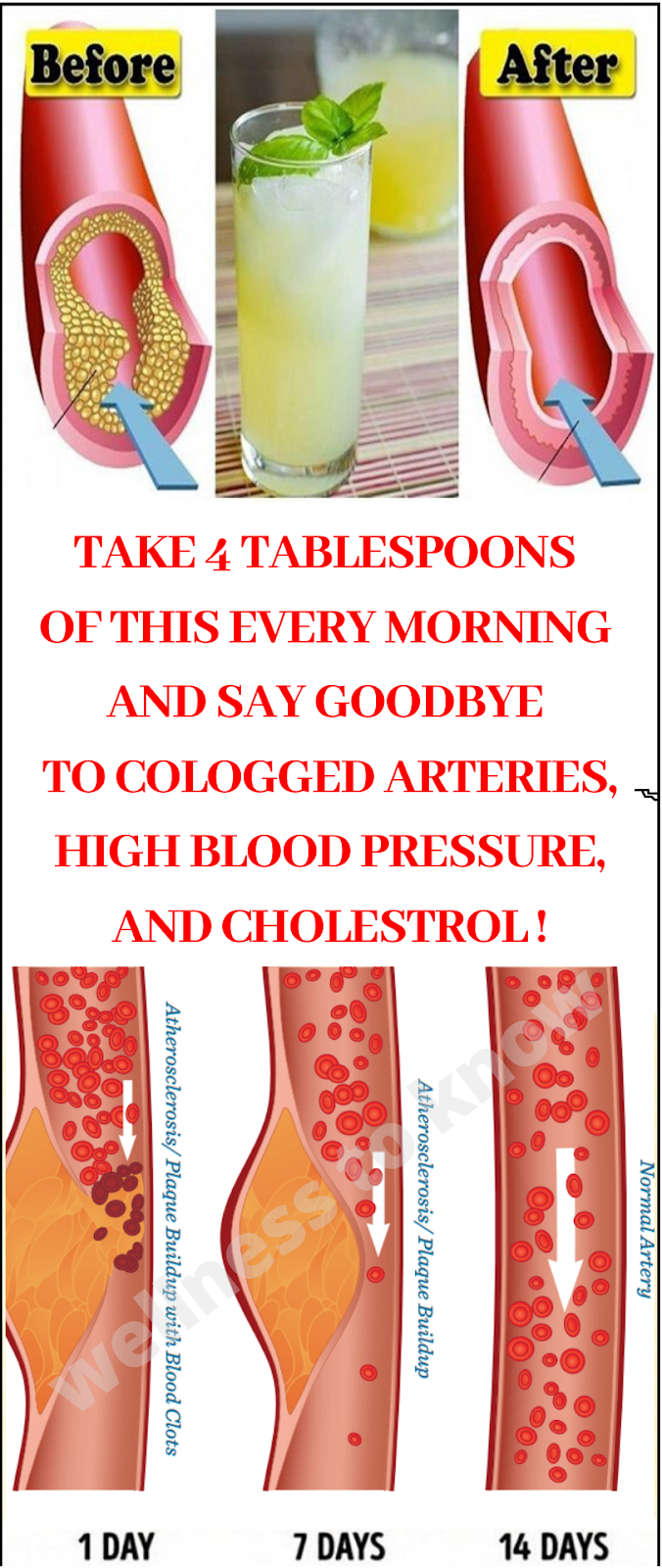 Take 4 Tablespoons Of This Every Morning And Say Goodbye To Clogged