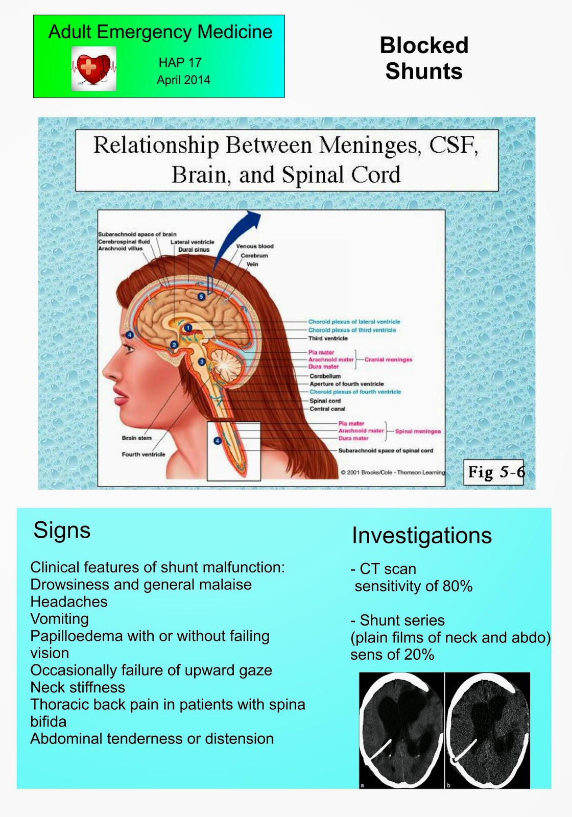Adult Emergency Medicine: Blocked VP Shunts