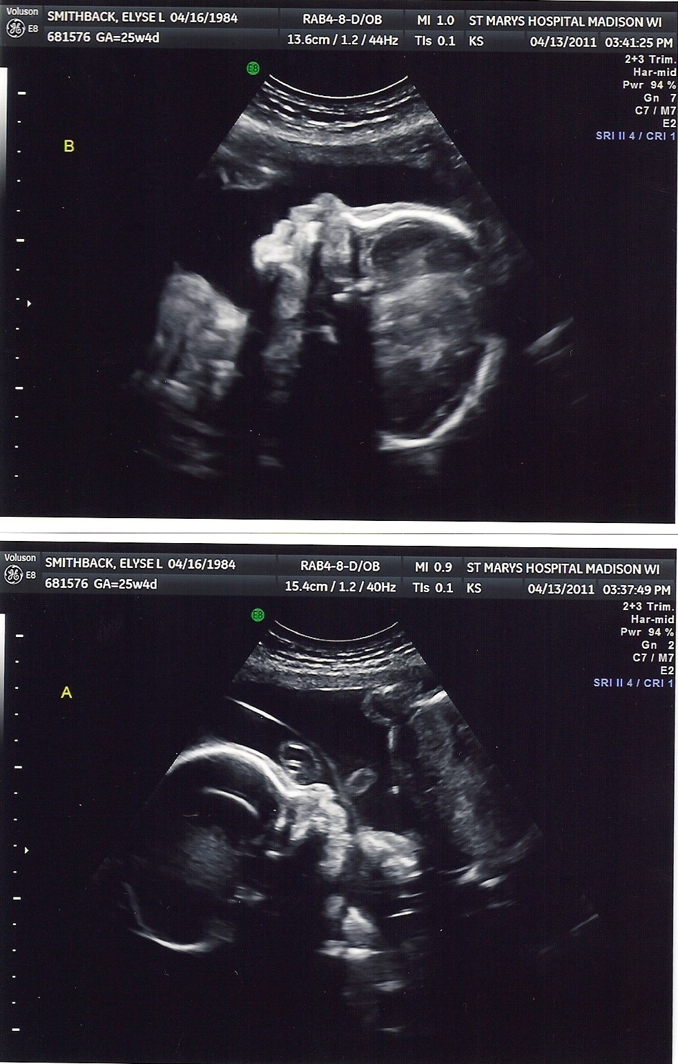 Smithback Twins: 26 Week Scan Pictures!